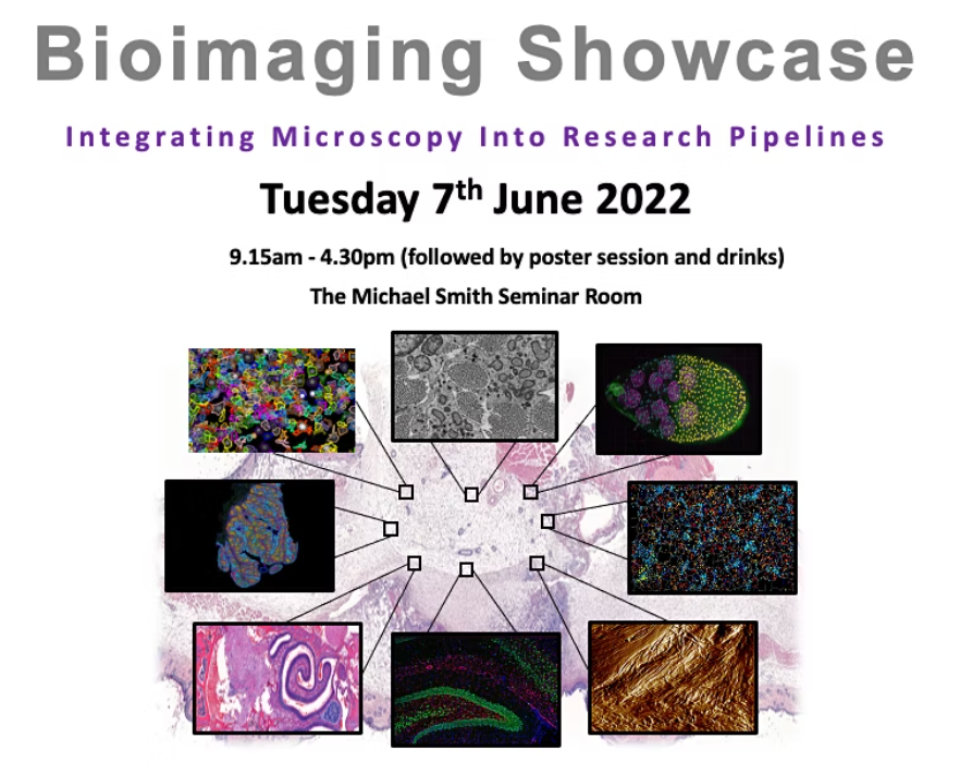 Alex presents at the Bioimaging Showcase - Nanomedicine Lab